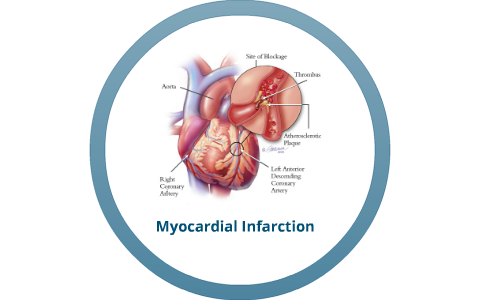 cardiovascular system by Elizabeth Horsman on Prezi