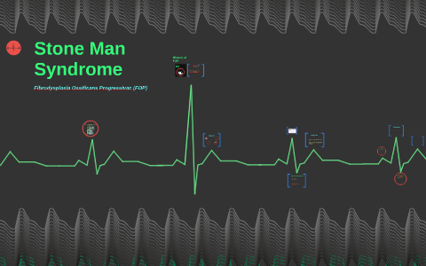 Stone Man Syndrome by Anna Baker on Prezi