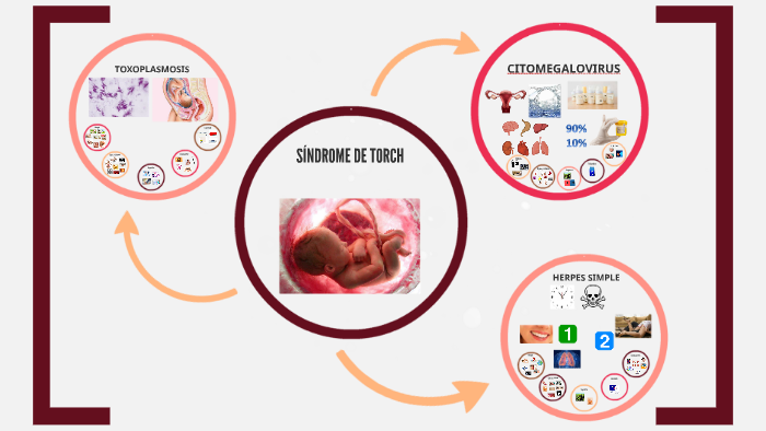 SÍNDROME DE TORCH by Marisol Básaca on Prezi