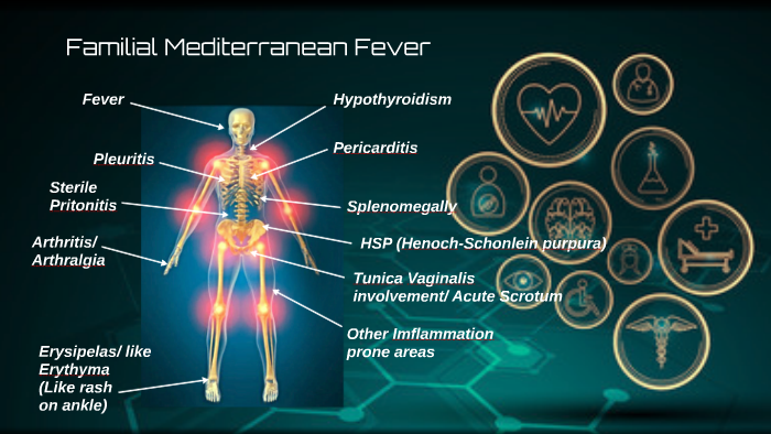 Familial Mediterranean Fever by Lori Tran on Prezi