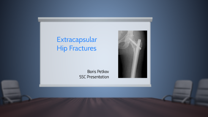 Extracapsular Hip Fractures by Boris Petkov on Prezi
