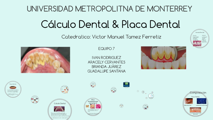 Calculo Dental & Placa Dental by Aracely Armstrong Cervantes on Prezi