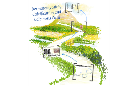 Dermatomyositis, Calcification and Calcinosis Cutis by Yihong Jia