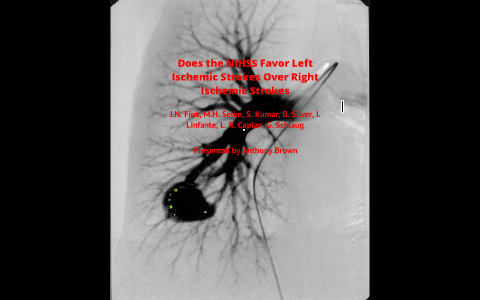 NIHSS left vs right stroke by Anthony Brown on Prezi