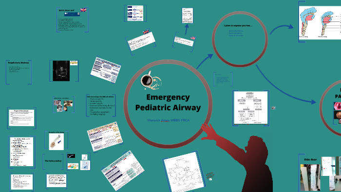 Pediatric Airway Algorithms by Warwick Ames on Prezi