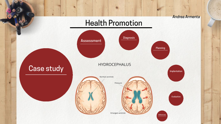 Hydrocephalus Concept Map by Andrea Armenta on Prezi