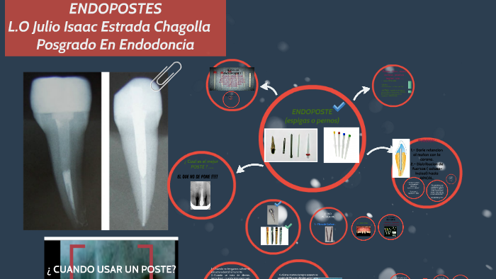 ENDOPOSTES by Julio isaac Estrada chagolla on Prezi