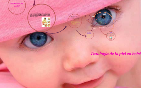 Patología de la piel en bebés by on Prezi
