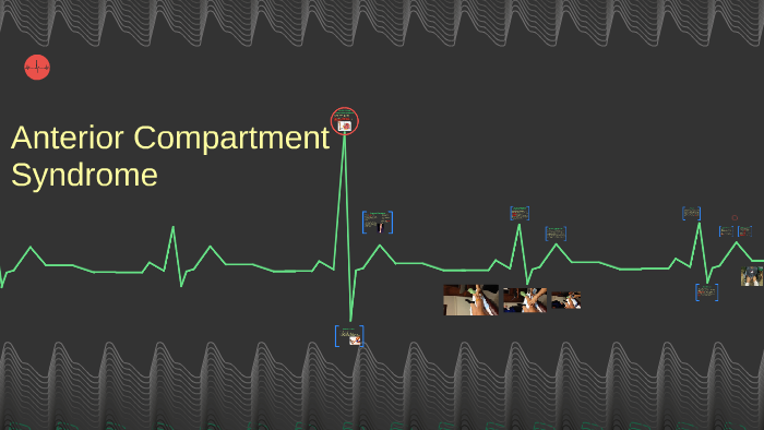 Anterior Compartment by morgan lundin on Prezi