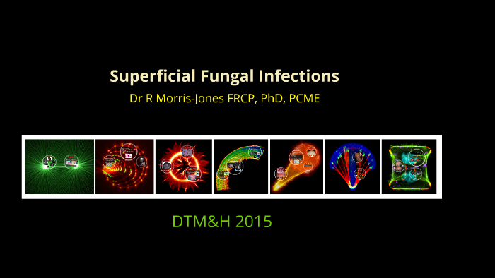 Superficial Fungal Infections DTM&H by rachael morris-jones on Prezi