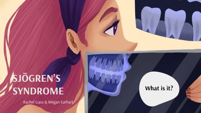 Sjögren's syndrome by Megan Earhart on Prezi