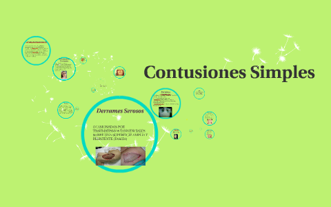 Contusiones Simples by on Prezi