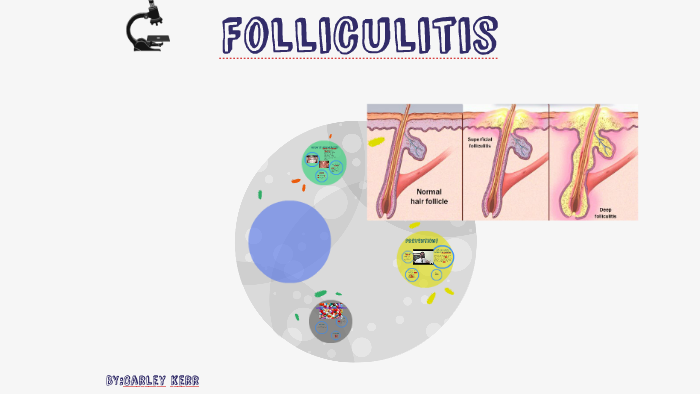 tis by carley kerr on Prezi
