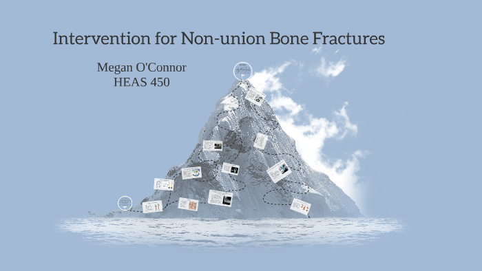 Bone Stimulation: Invasive vs Non-Invasive by Megan O'Connor on Prezi