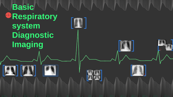 Basic Respiratory system Diagnostic Imaging by Shayan Azizi on Prezi
