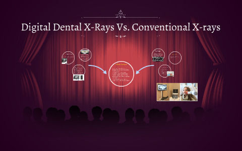 Digital Dental X-Rays vs.Conventional X-Rays by Lilia Zúñiga on Prezi