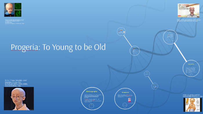 Progeria: To Young to be Old by Adam Miller on Prezi