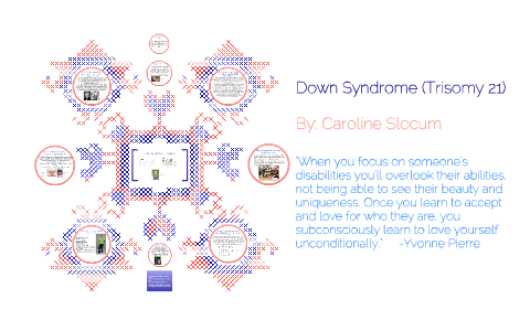 Down Syndrome by Caroline Slocum on Prezi