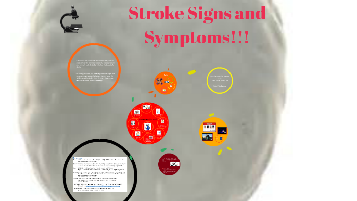 Stroke Signs and Symptoms by Laura Shawley on Prezi