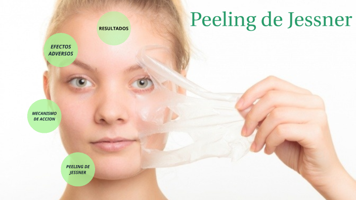 Peeling de Jessner by silvia anderson on Prezi