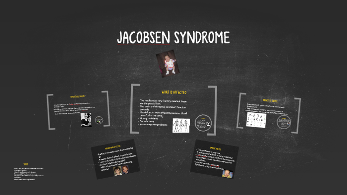 JACOBSEN syndrome by Daniela Garduno