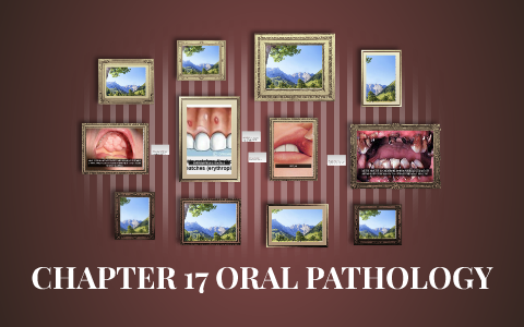 CHAPTER 17 ORAL PATHOLOGY by angel cortez on Prezi