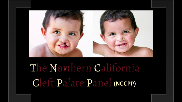The Northern California Cleft Palate Panel by liz lee on Prezi
