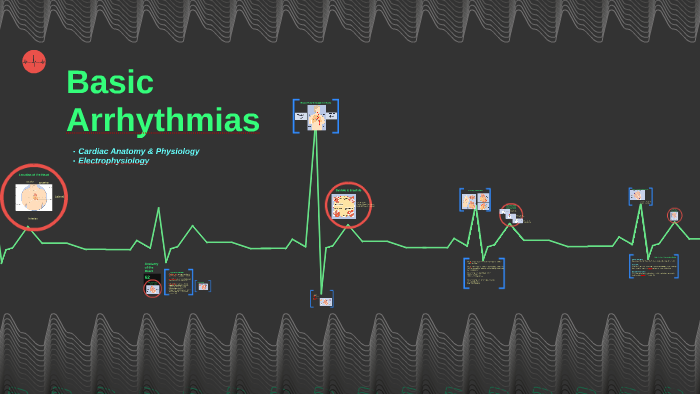 Basic Arrhythmias by Sarah Fry on Prezi