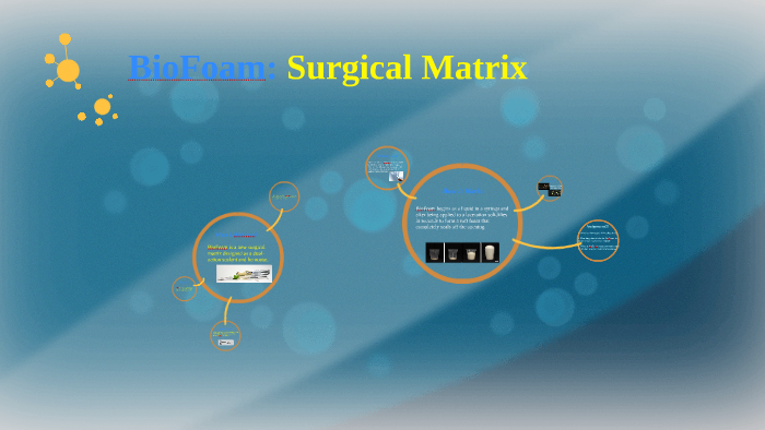 BioFoam: Surgical Matrix by Chase Coleman on Prezi