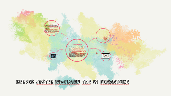 Herpes Zoster Involving the S1 Dermatome by Joselyn Mancheno Garcia on ...