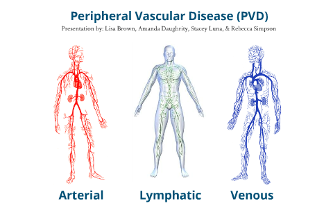 Physical Therapy with Peripheral Vascular Disease (PVD) patients. by ...