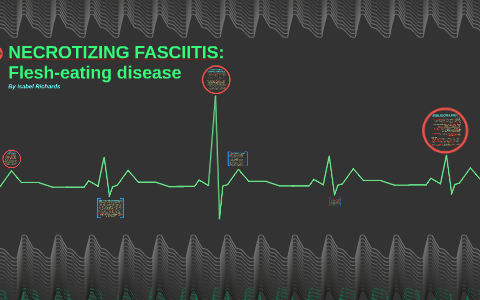 NECROTIZING FASCIITIS: Flesh-eating disease by Izzie Richards on Prezi