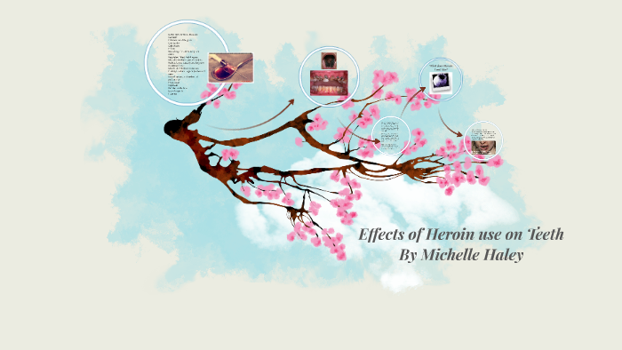 Effects of Heroin use on Teeth by Michelle Haley on Prezi