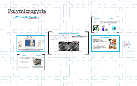 Polymicrogyria by elizabeth casillas on Prezi