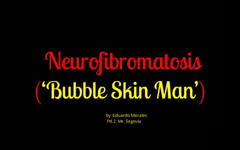 Bubble skin man by eduardo morales on Prezi