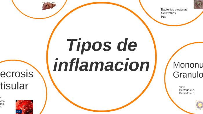 Tipos de inflamacion by Juan Francisco Negrete on Prezi