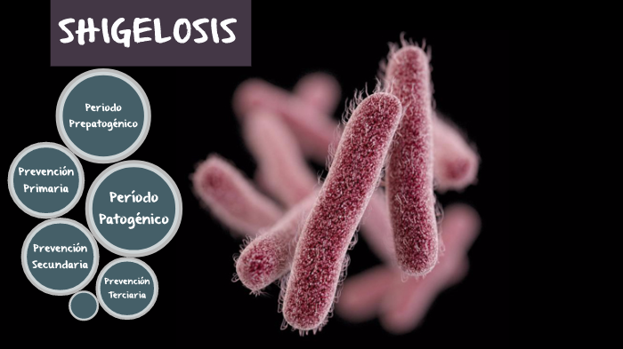 SHIGELOSIS by Valeria S. Cruz on Prezi