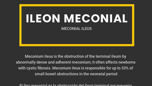 Ileon meconial by sara valentina peña on Prezi Design
