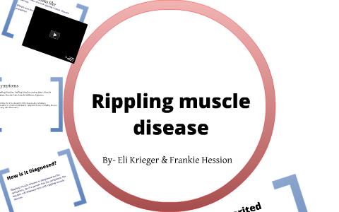 Rippling muscle disease by Eli Krieger and Frankie Hession by Toni ...
