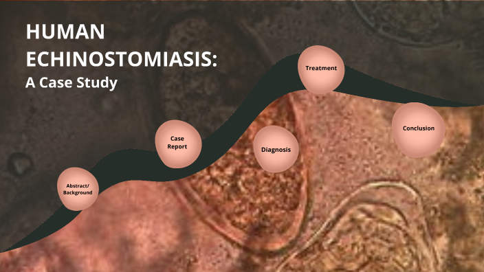 ECHINOSTOMIASIS by Angelika Kaamino on Prezi