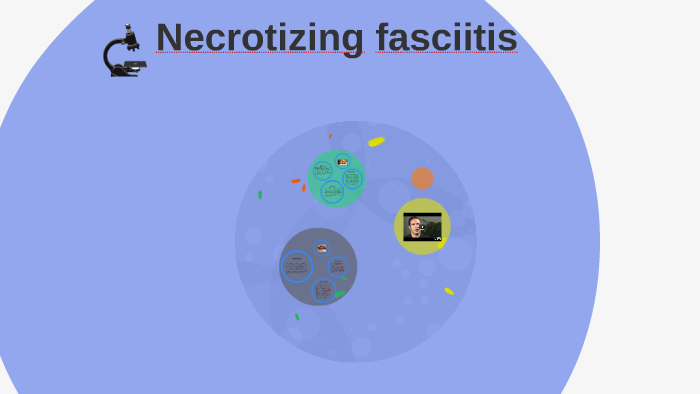 Necrotizing Fac by annie Butcher on Prezi