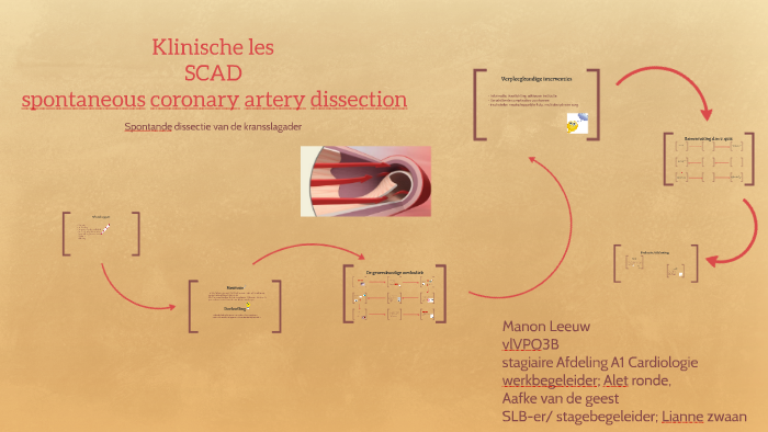 SCAD Spontaneous coronary artery dissection by Manon Leeuw