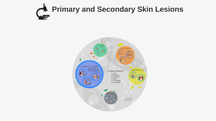 Primary and Secondary Skin Lesions by Rebecca Dicken on Prezi