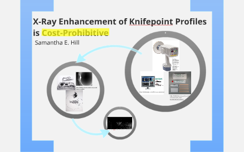 X-Ray Enhancement of Knifepoint Profiles is Cost-Prohibitive by ...