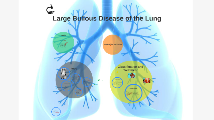 Large Bullous Disease of the Lung by Khalid Altabash on Prezi