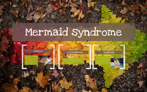 Mermaid syndrome by Desarie Turner on Prezi