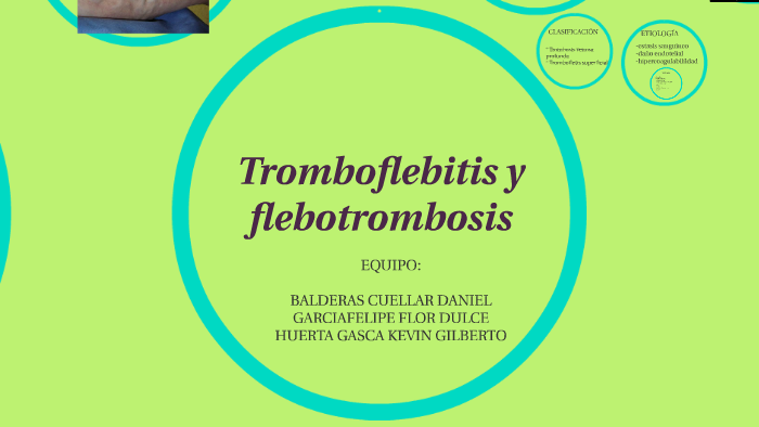 Tromboflebitis y flebotrombosis by Kevin Huerta on Prezi