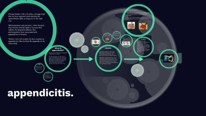 appendicitis. by adys peralta