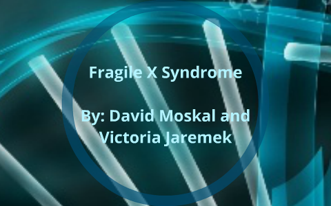 Fragile X Syndrome by David Moskal on Prezi