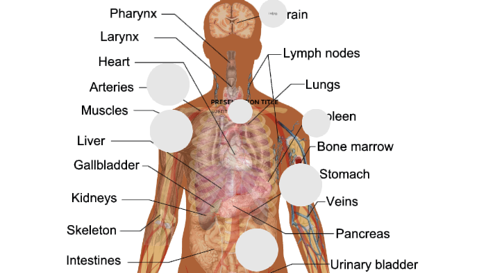 kidney stones by Audrey Venable on Prezi